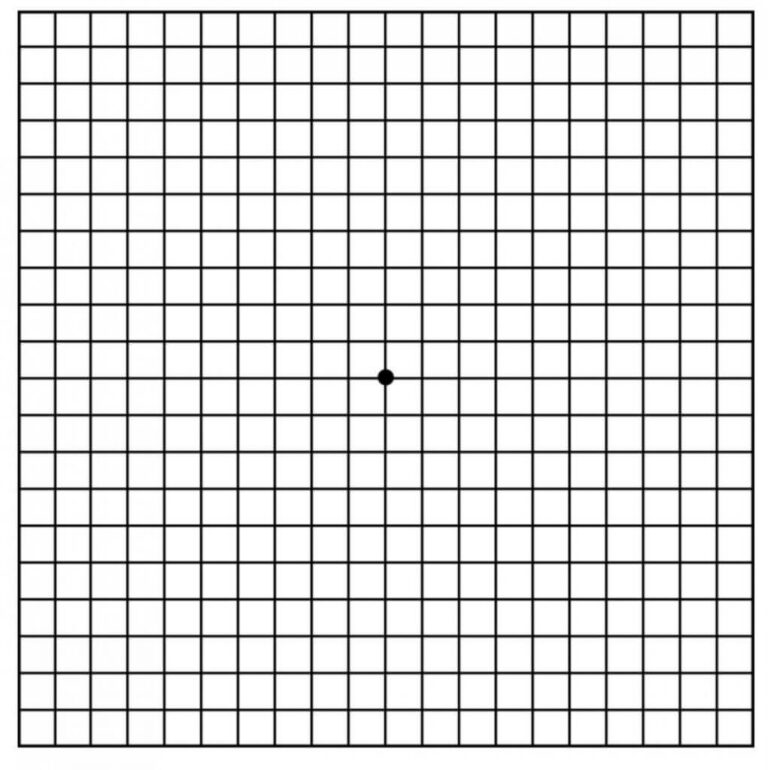 Retinal Disorders St. Joseph | Macular Degeneration Cameron, MO